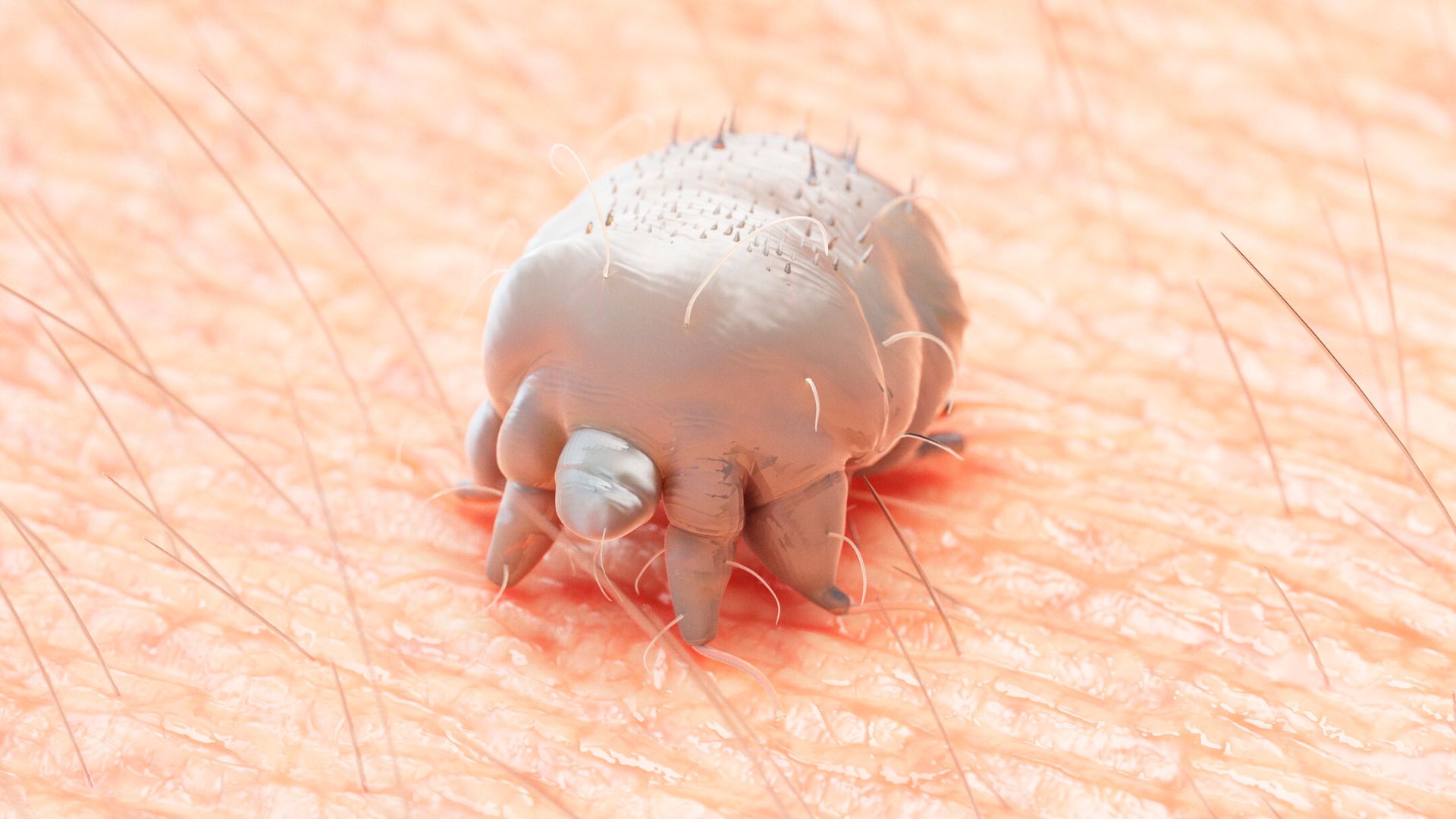 Acaro della scabbia, disinfestazione acari | Servizipid.it